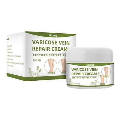Varicose Veins Cream Varicose Vein Treatment Cream For Legs