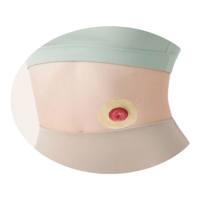 汇锦然ostupmed造口防漏圈防漏贴环1703 造口附件可塑贴环 一盒装