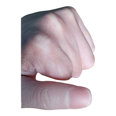 丹蓉通用上海高端取模硅胶假肢好