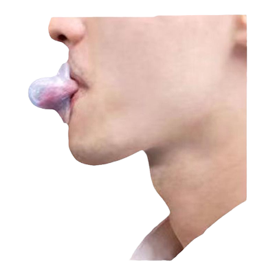 打呼噜舌套成人止鼾神器口腔