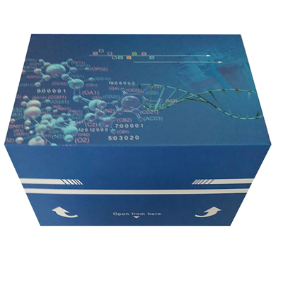 人（Human）抗EB病毒抗体（EBV）ELISA检测试剂盒 定制