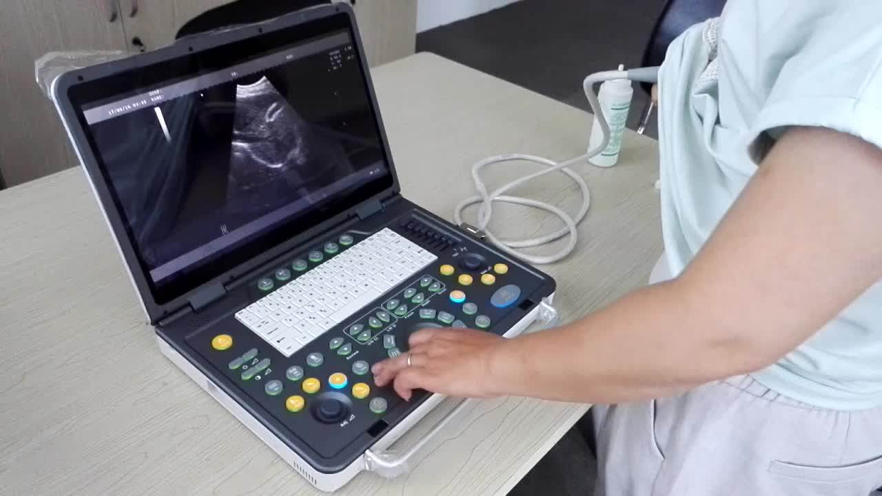 Portable Ultrasonic Diagnostic Ultrasound Devices With Suitcase - Buy ...