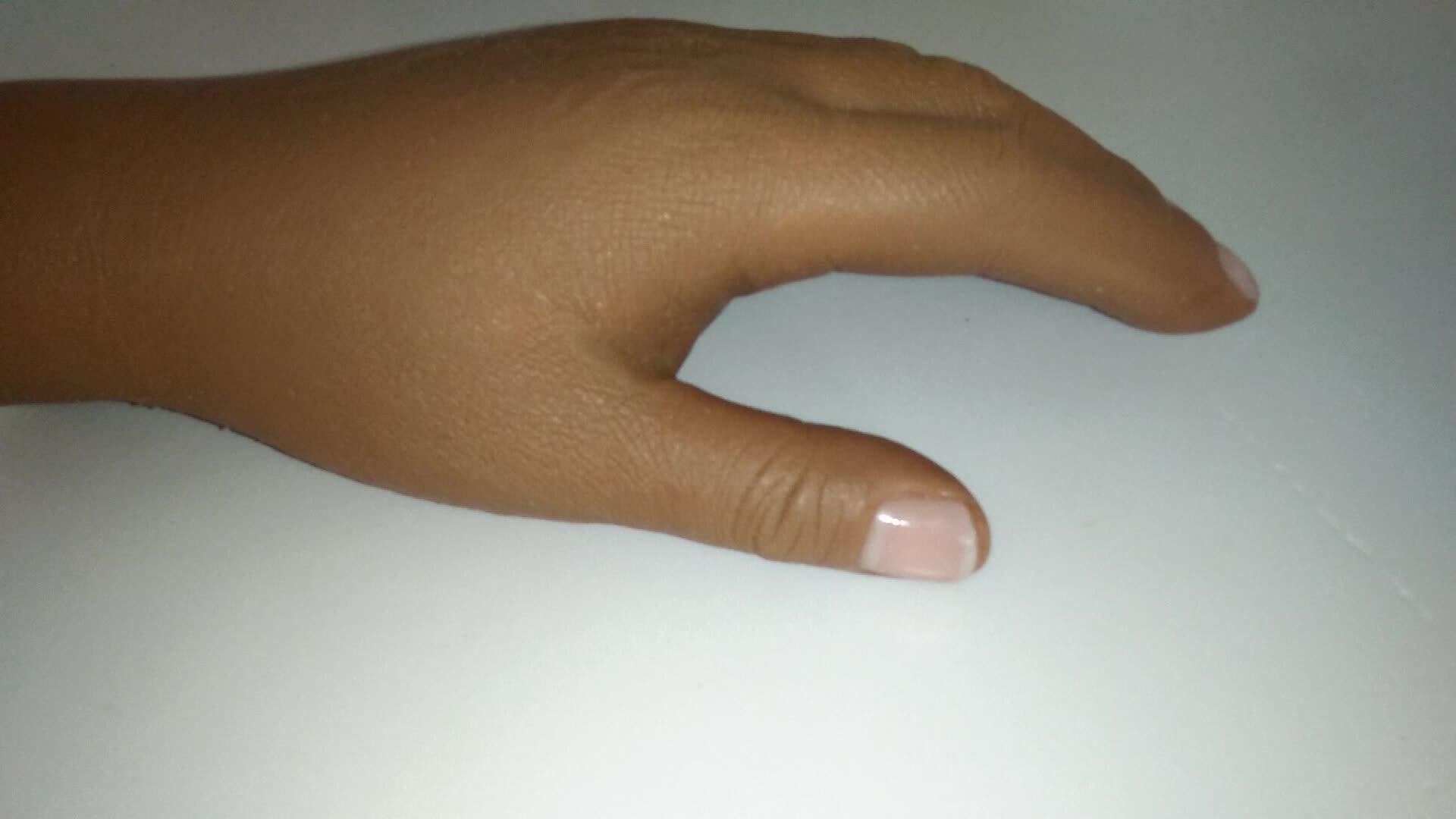 Prosthetic Silicone Cosmetic Hand Cover For Partial Hand Amputation ...