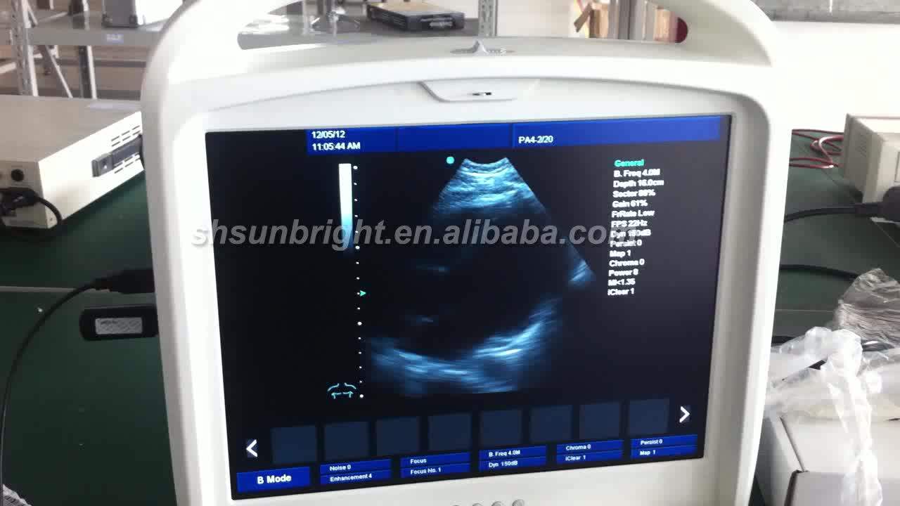 Portable Echocardiography Machine 2d Echo Cardiac Color Doppler - Buy ...
