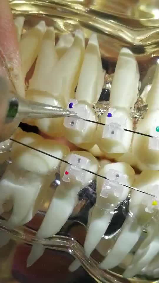 Easyinsmile Ceramic Orthodontic Brackets Roth 022 Self Ligating Dental ...