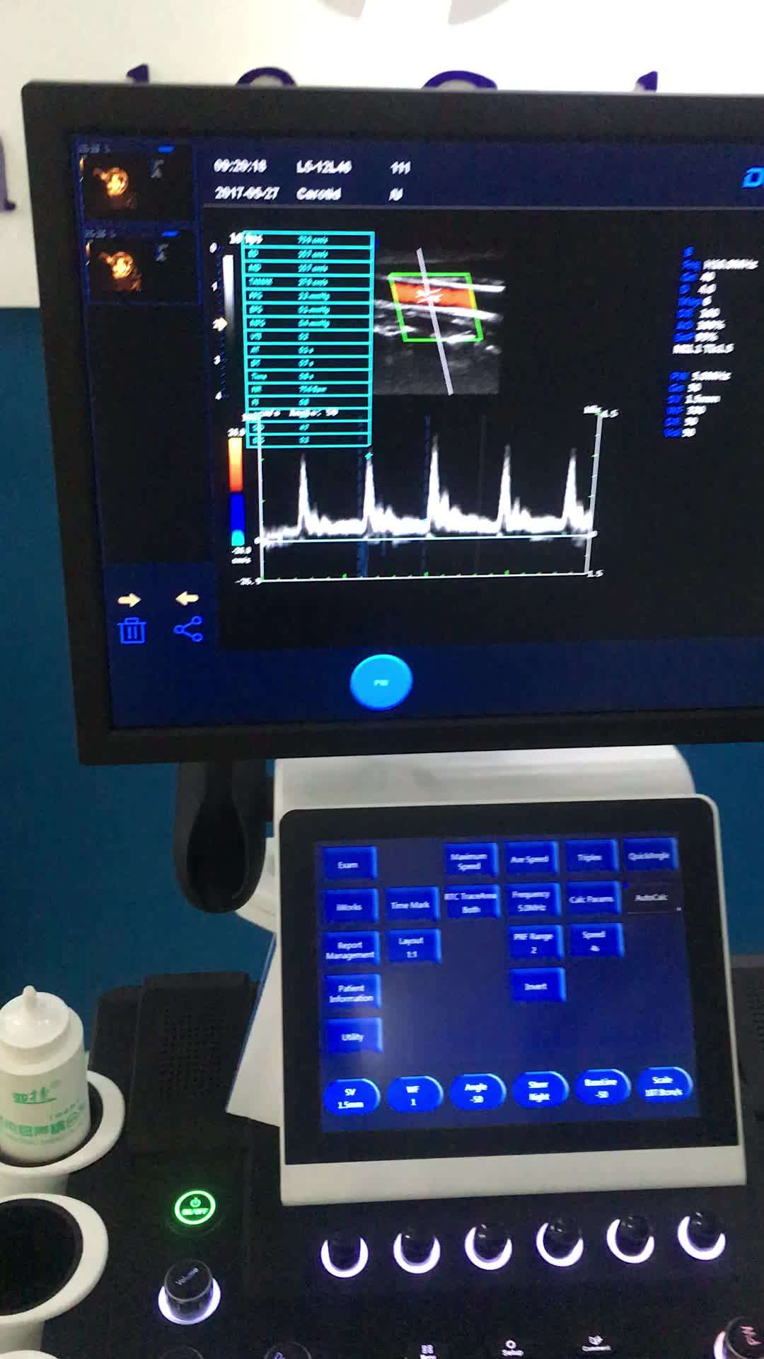 Medical 4d Echo Ultrasound & 4d Color Doppler Ultrasound Machine - Buy ...