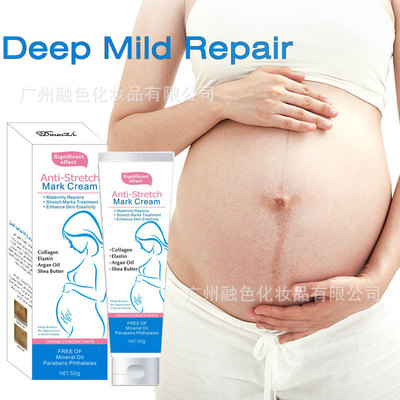 严选跨境身体乳肚纹霜清爽不油腻滋润去生长纹Stretch mark cream