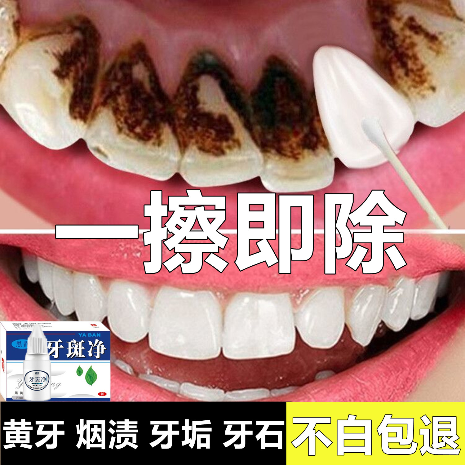 洗牙粉美白去黄洗牙齿污垢变亮白去除烟渍清洁神器牙结石溶解速效