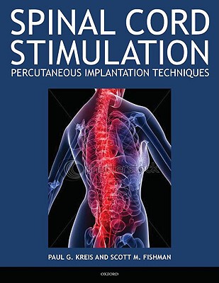 【预售】Spinal Cord Stimulation: Percutaneous Implantation