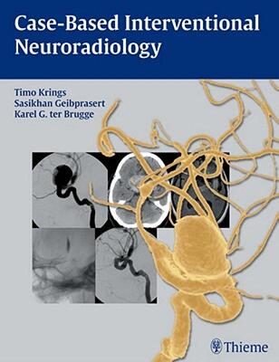 【预售】Case-Based Interventional Neuroradiology [With