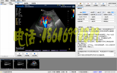 淳仁超声彩超软件胃肠镜宫腹腔镜耳鼻喉镜PACS系统CT/CR/DR软件