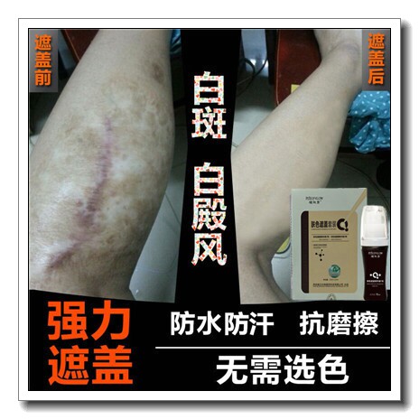 外用原色肤色持久遮盖液白殿风药膏白斑净遮瑕笔修饰防水防汗正品