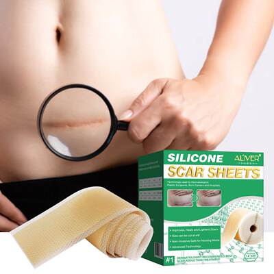 Potongan Gel Silikon ALIVER Koyo Lembaran Bekas Luka Silikon