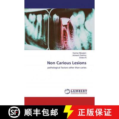 预订 Non Carious Lesions [9786202521512]