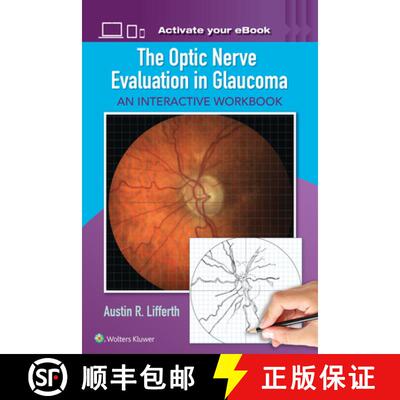【3-4周达】The Optic Nerve Evaluation in Glaucoma : An Interactive Workbook [9781496363138]