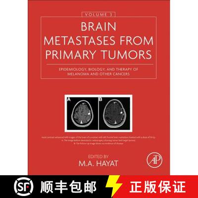 【3-4周达】精装 Brain Metastases from Primary Tumors, Volume 3: Epidemiology, Biology, and Therapy of... [9780128035085]