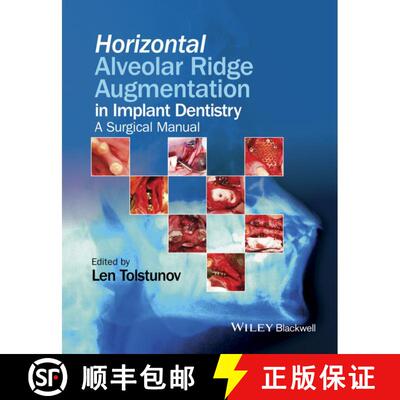 【3-4周达】精装 Horizontal Alveolar Ridge Augmentation In Implant Dentistry: A Surgical Manual [Wiley... [9781119019886]