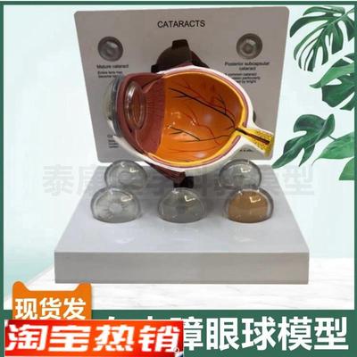 白内障眼b睛模型可拆卸眼科医生用晶状体病变眼底视网膜神经血管