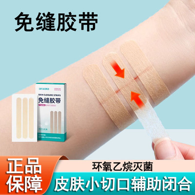 医用减张贴无菌免缝胶带