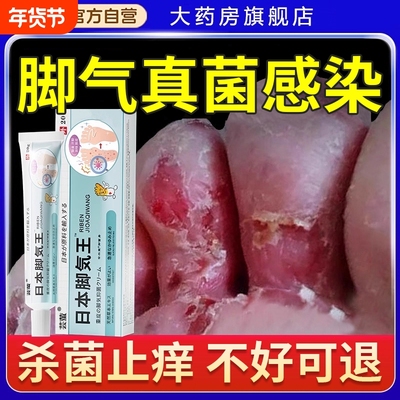 脚气臭脚痒出汗脚气喷雾止脱皮抑真菌脚泡脚丫根趾缝糜烂痒专用