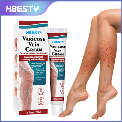 Varicose Vein Relief Cream Effectively Relieves Leg Swelling