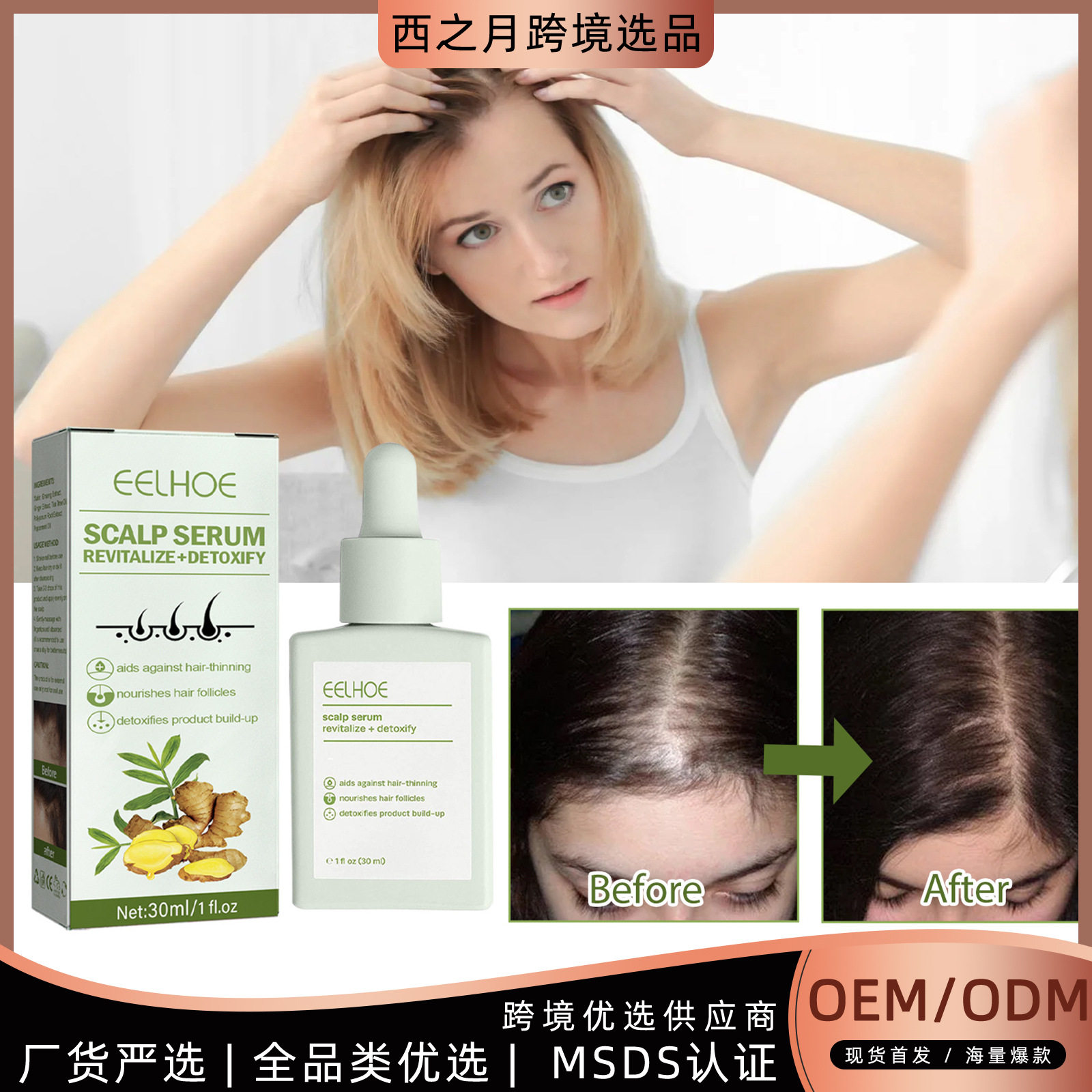 EELHOE密发头皮精华素防掉护发滋润修护头皮强韧秀发浓密按摩精油