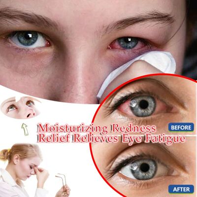 Solu??o hidratante para os olhos, 15ml, remover a fadiga e a