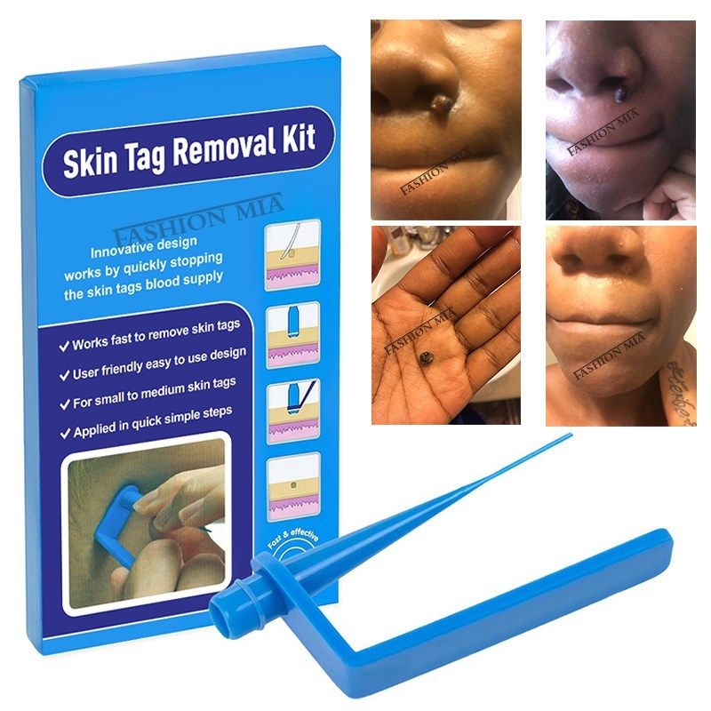 Remover-Kit Skin-Care-Tools Face-Skin-Tag-Removal-Patch Acne_虎窝淘