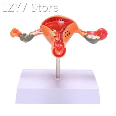 Uterus Model Ovary Model Anatomy Female Reproductive Organ M