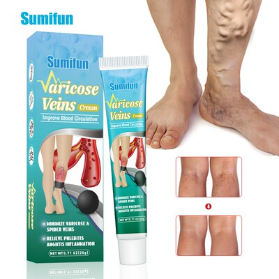 Varicose Veins Cream Patch Improve Blood Circulation