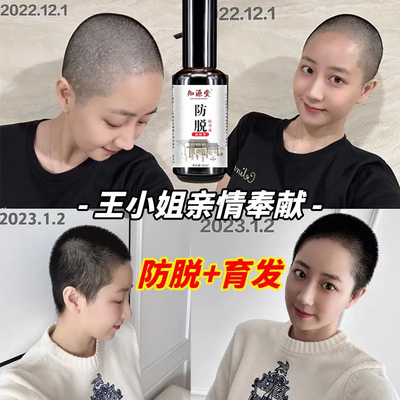 除脂生发片祺笑正品保证脂溢性脱发快速脱发白发