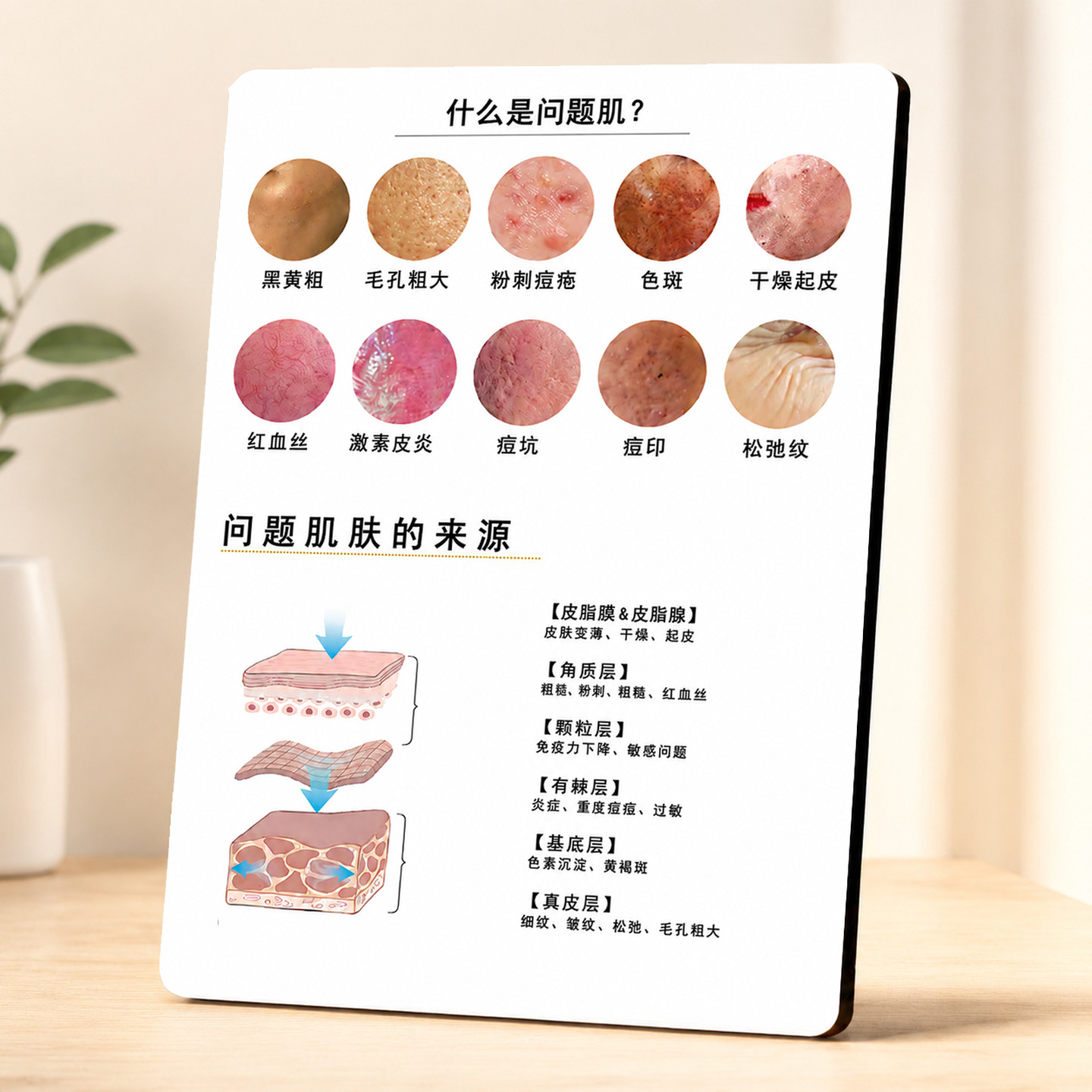 美容院什么是问题肌科普装饰摆件皮肤管理门店桌面展示立牌