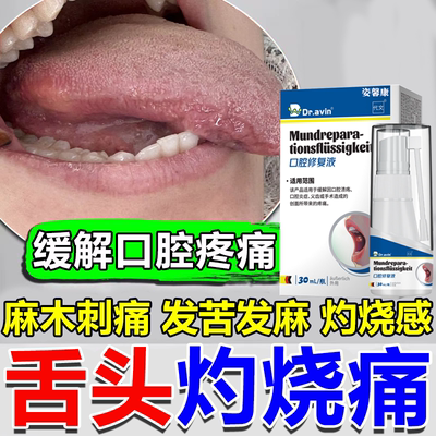 灼口综合征女性更年期舌头麻木疼痛发苦灼伤舌炎刺痛代文喷雾剂wg