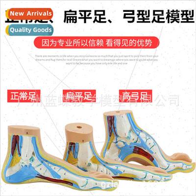 Normal foot Flat foot Arched foot Foot muscles Foot muscle a