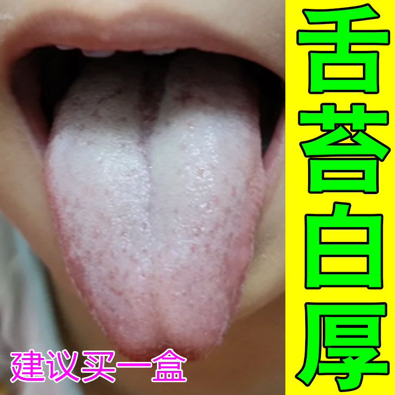 舌苔白厚舌体肥大易留压痕舌面发白厚重表层开裂口腔内里燥热不适