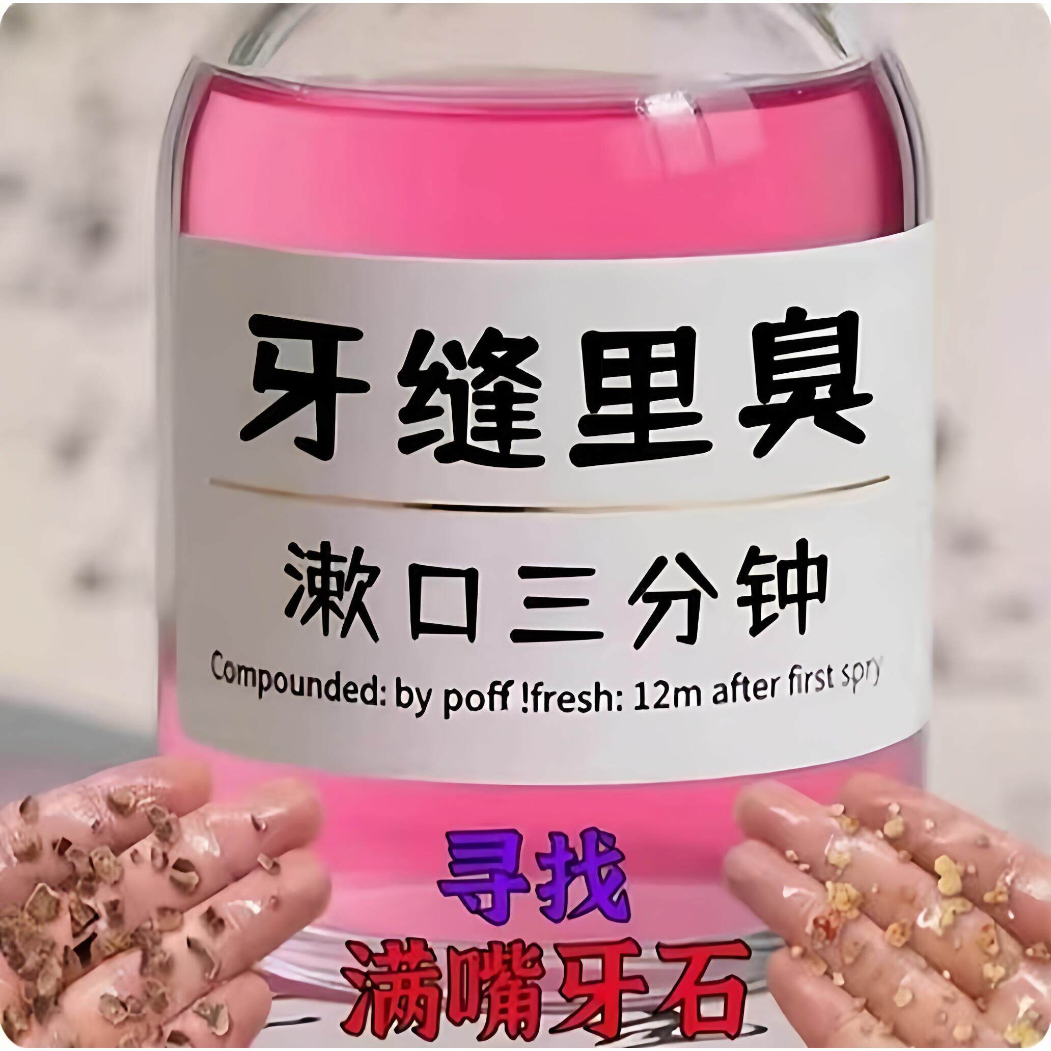【爆款】牙石溶解漱口水洗牙齿污垢牙垢牙黄牙渍清理