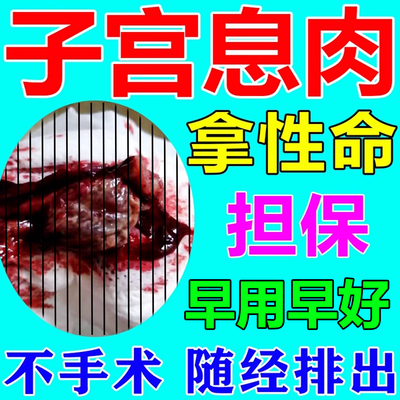 子宫息肉药贴】一贴排出无效全退
