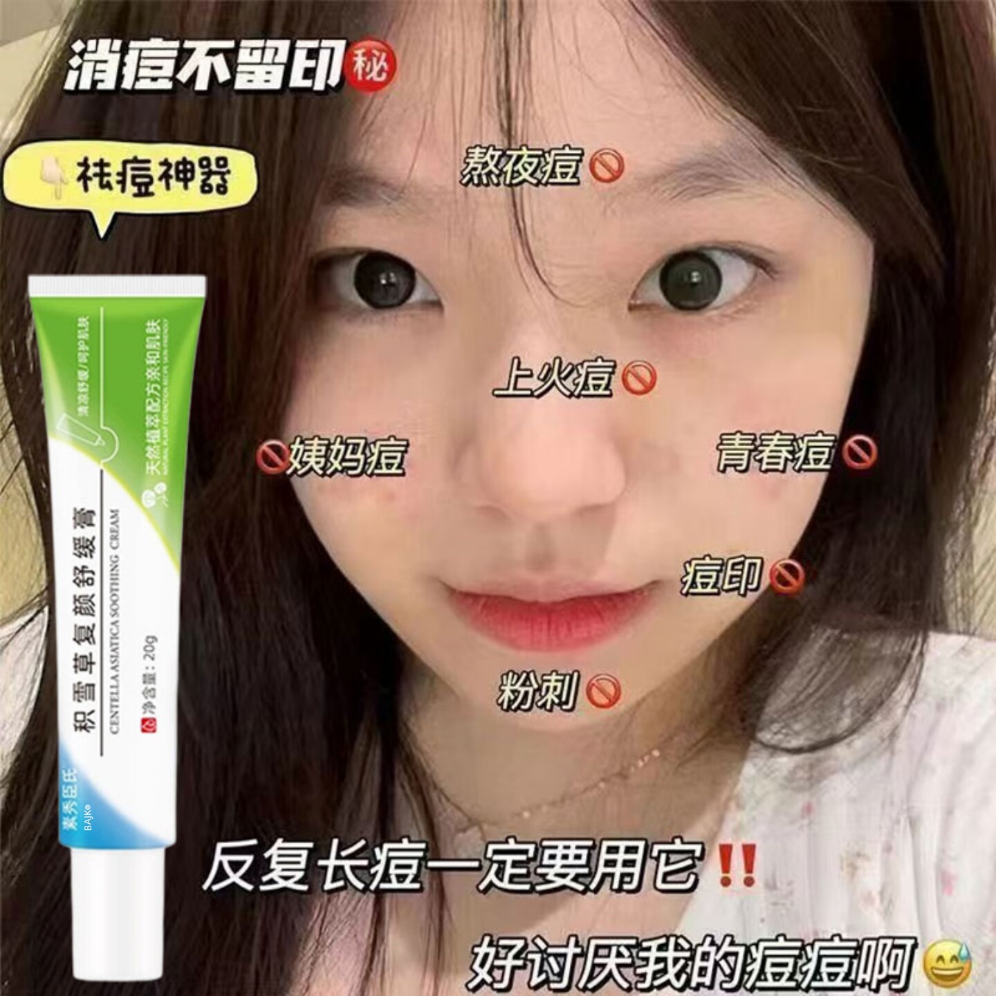 积雪草苷霜软膏祛痘印坑淡化黑色素沉淀官方旗舰店正品消红复颜乳