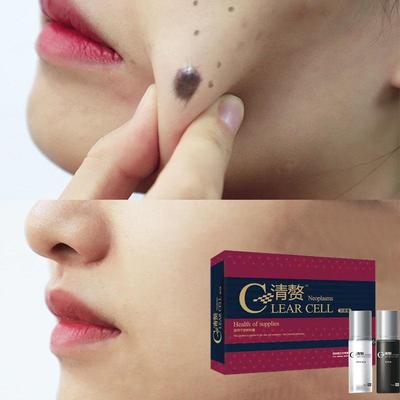 极速点痣去痣无痕l药水去黑痣肉痣贴点斑膏祛痣神器修复黑点脸部