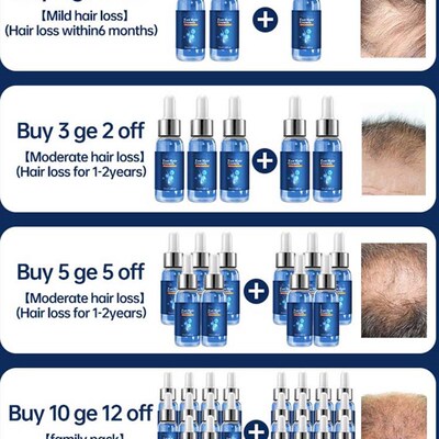 好货Fast Hair Growth Hair Growth Oil Effective Baldness Repa