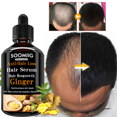 好货Hair Growth Products Natural Anti Hair Loss Prevent Bald