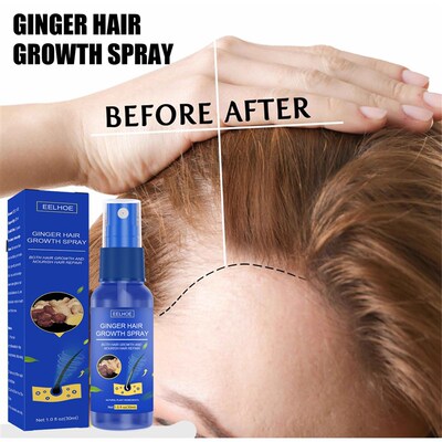 极速EELHOEGinger Hair Growth Serum Spray AnNti Hair Loss Reg