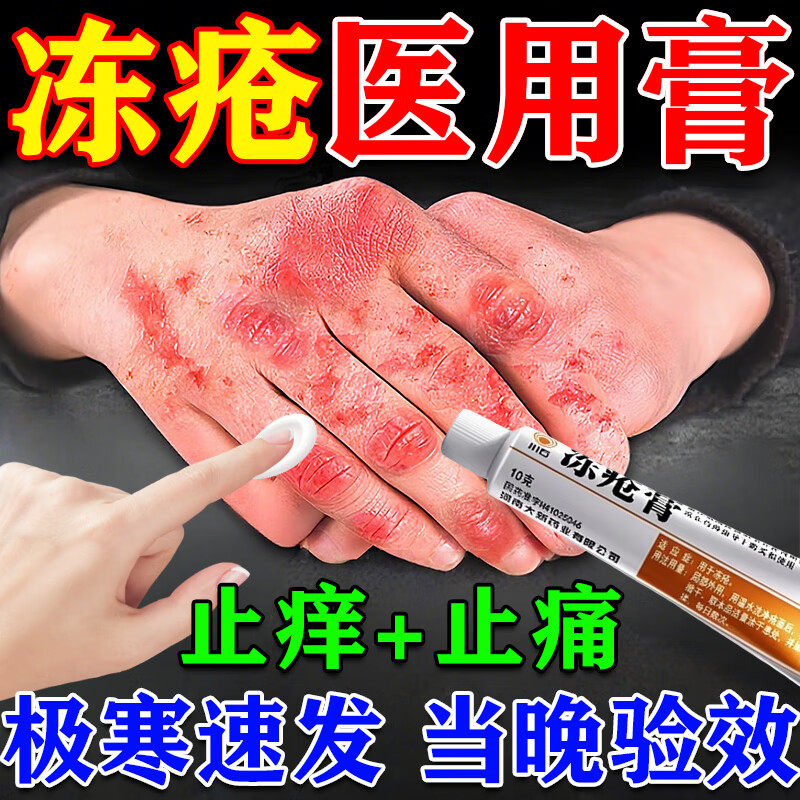 冻疮膏止痒冻伤膏耳朵脸部手指冻伤皲裂脚红肿痒痛成人儿童防冻