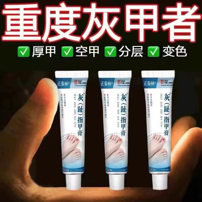 脚指甲增厚灰指甲专用药膏重度厚甲脚趾手指灰指甲正品专用灰甲净