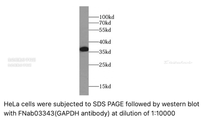 FineTest未标记一抗GAPDH抗体内参抗体适用ELISA,IHC,WB,IF,FC,IP