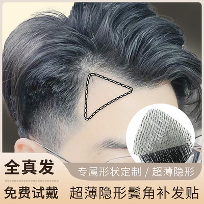 发际线贴男鬓角假发男女全真发补发前额遮秃m型刘海隐形补发贴片
