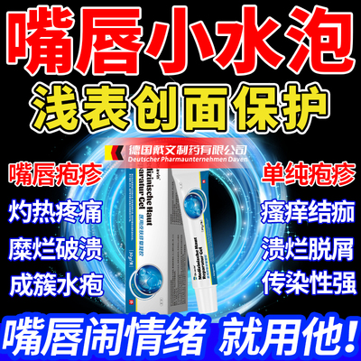德国戴文--嘴唇疱疹烂嘴角药膏