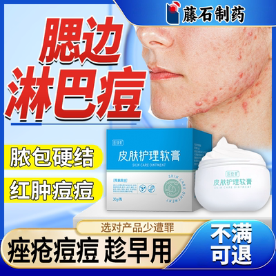 腮边淋巴痘下巴红肿硬块下颚线脸上痤疮囊肿结节痘痘脓疱搭药膏QN