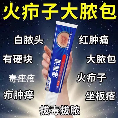 苗疆火疖子拔脓拔毒膏屁股长痤疮硬块坐板疮红肿大脓包脸部痘痘T5