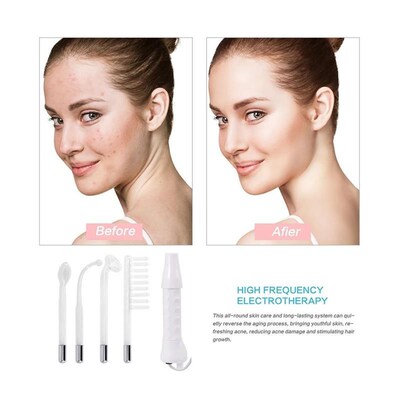 4 In 1 High Frequency Facial Wand Portable Electrotherapy Gl